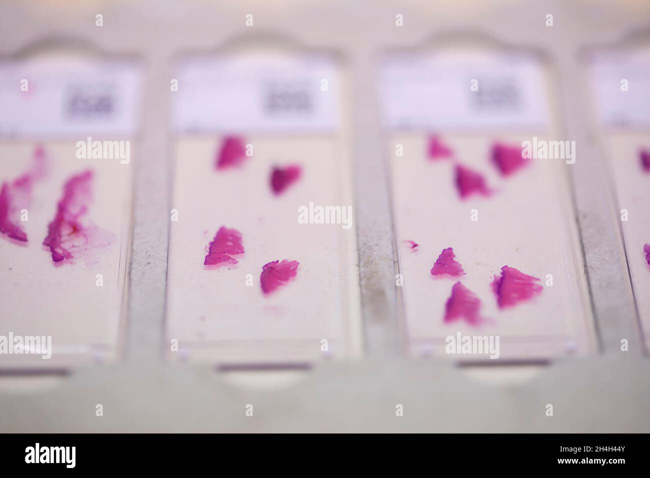 Embedded samples in a histology laboratory, Freiburg, Baden ...