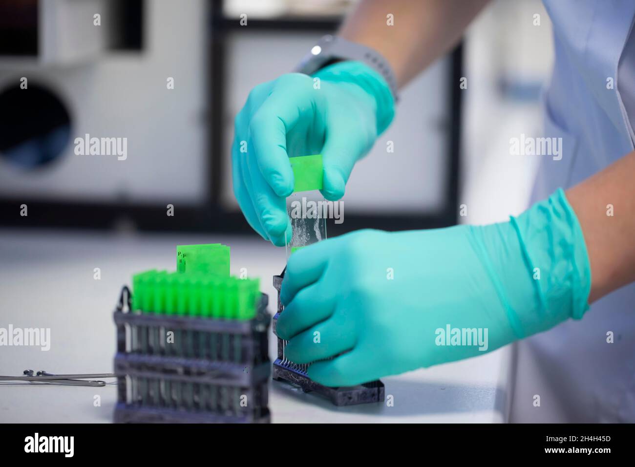 Processing of samples in a histology laboratory, Freiburg, Baden ...