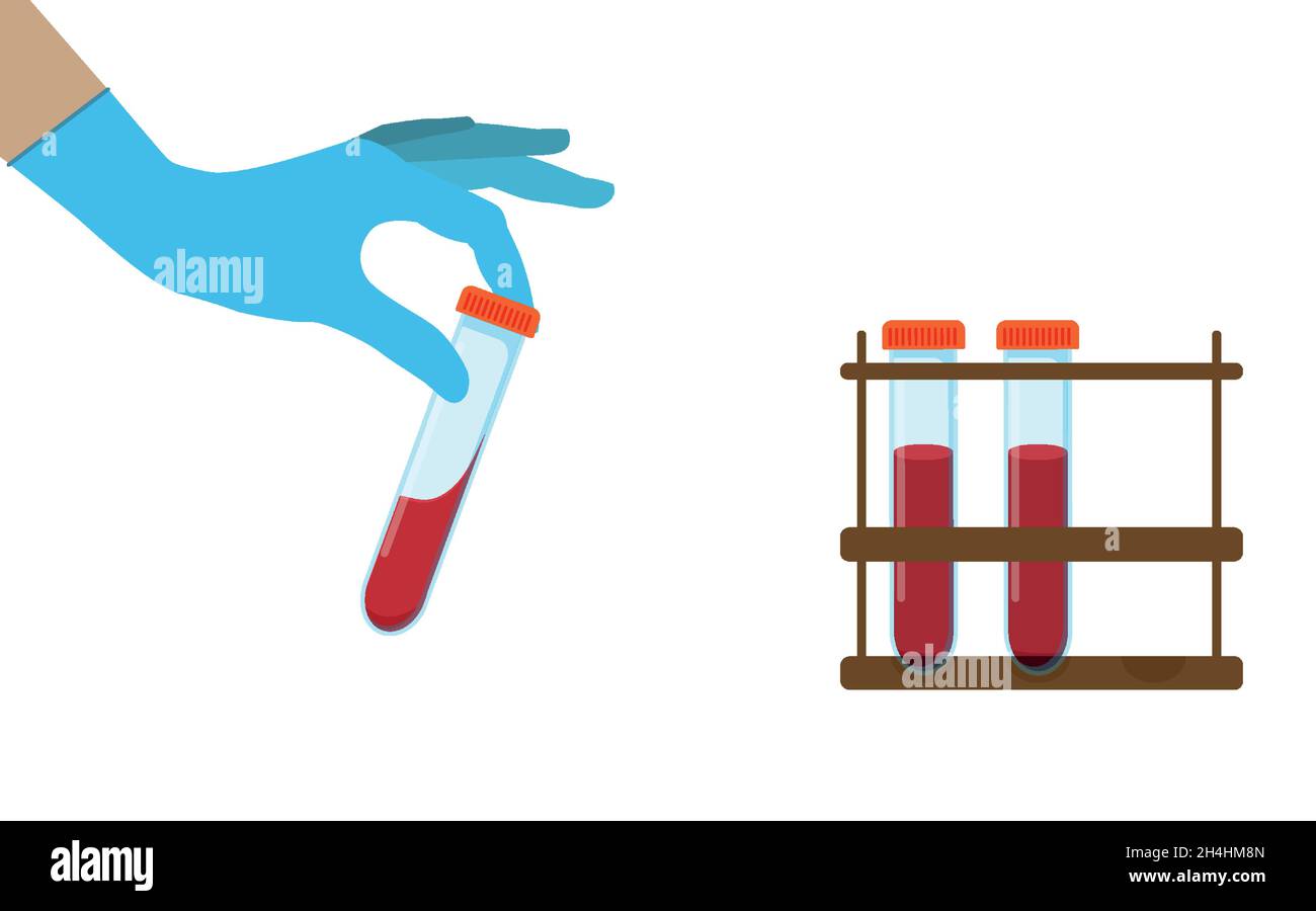Flasks with blood components a test tube with blood, a medical test ...