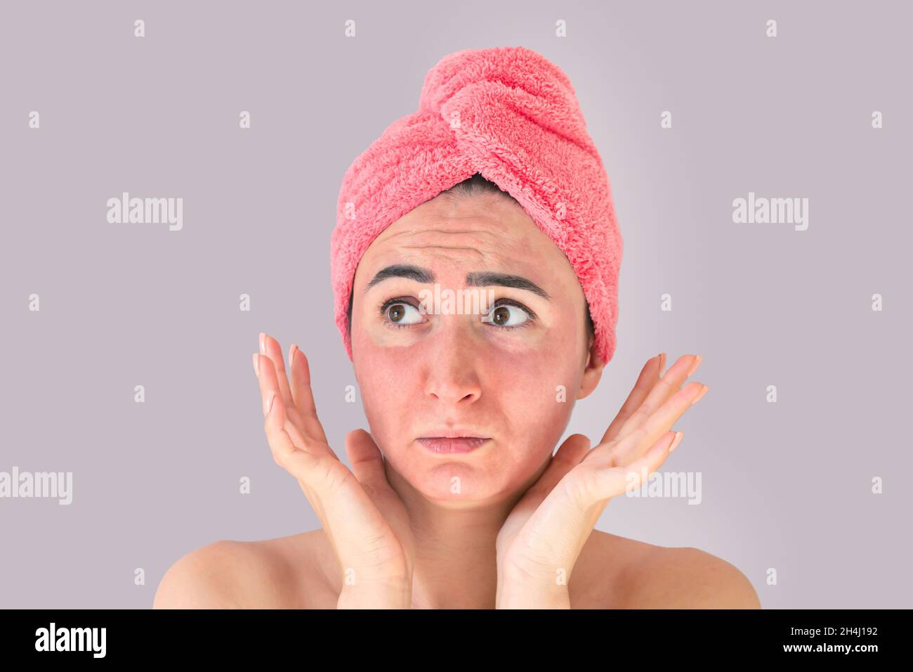 Sad face of young woman with skin irritation, redness, skin problems ...