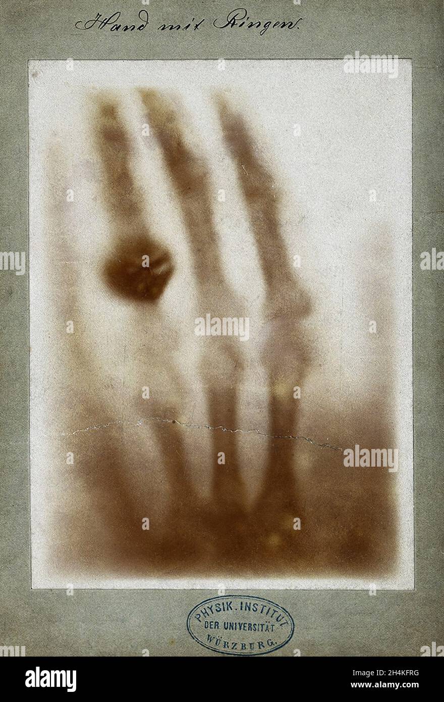 Röntgen hand x ray hi-res stock photography and images - Alamy