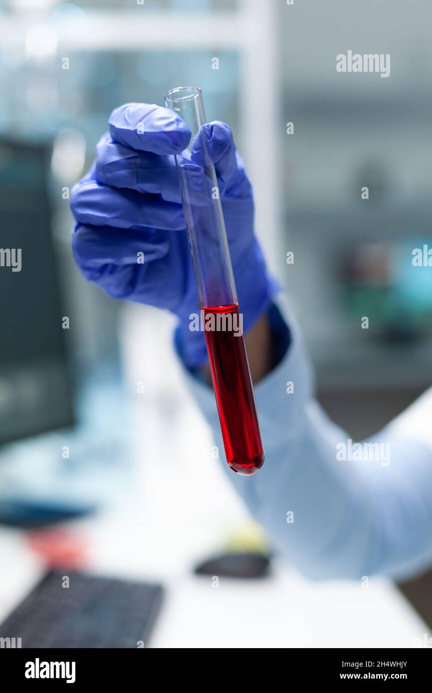 Closeup of biologist chemist holding medical test tube with blood ...