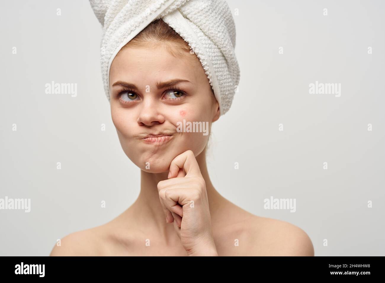 woman with a pimple on the face skin problems close-up Stock Photo - Alamy