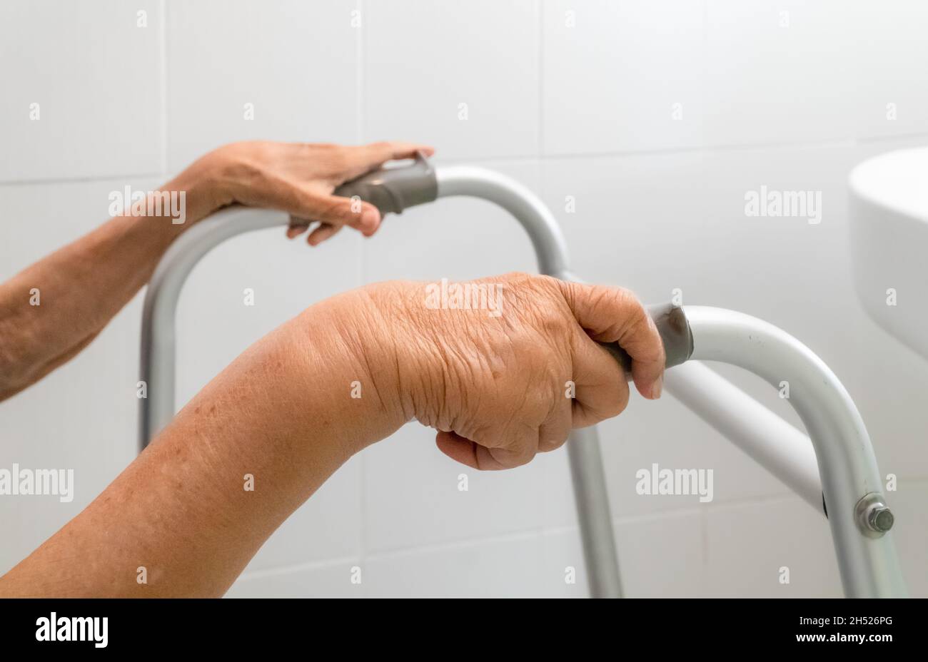Edema hand hi-res stock photography and images - Alamy