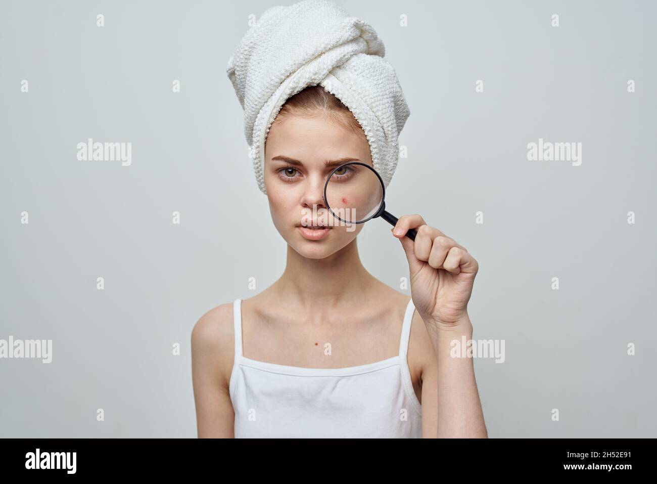 beautiful woman with a pimple on the face skin problems close-up Stock ...