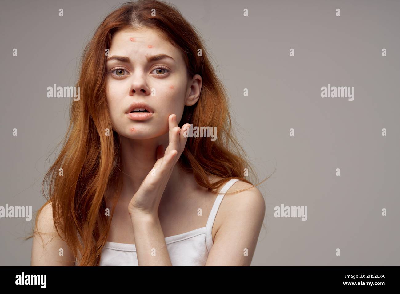 pretty woman facial skin problems dermatology isolated background Stock ...