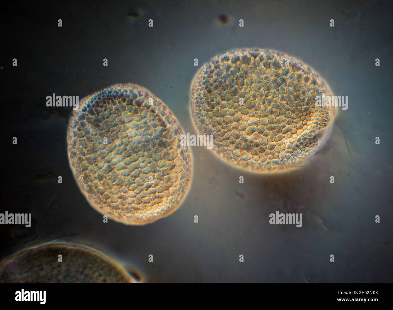 Lily pollen, darkfield photomicrograph Stock Photo - Alamy