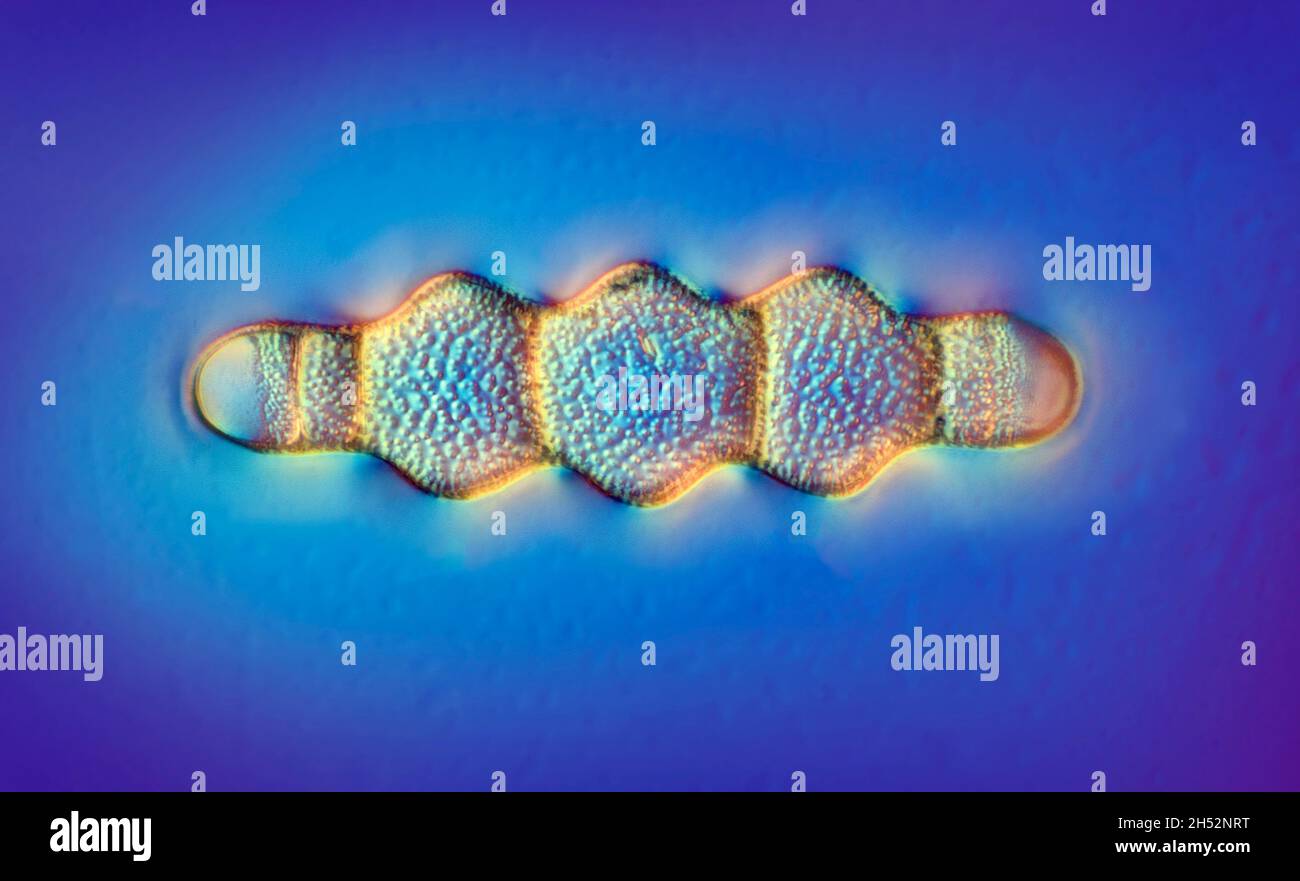 Diatom, Terpsinoë musica, Leitz Heine condenser illumination Stock ...
