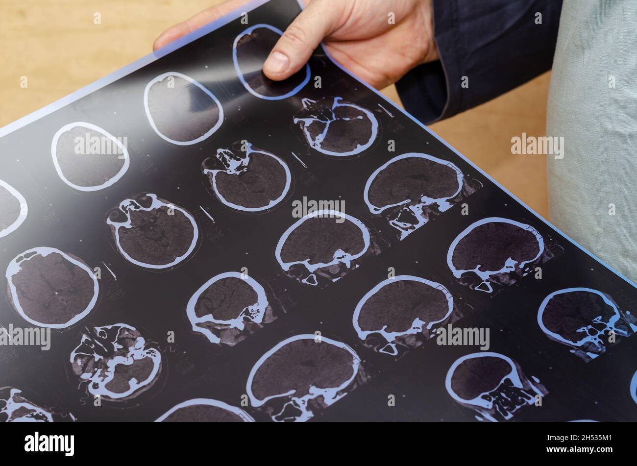 Adult male holding a CT scan of the brain. Examination of a patient in ...