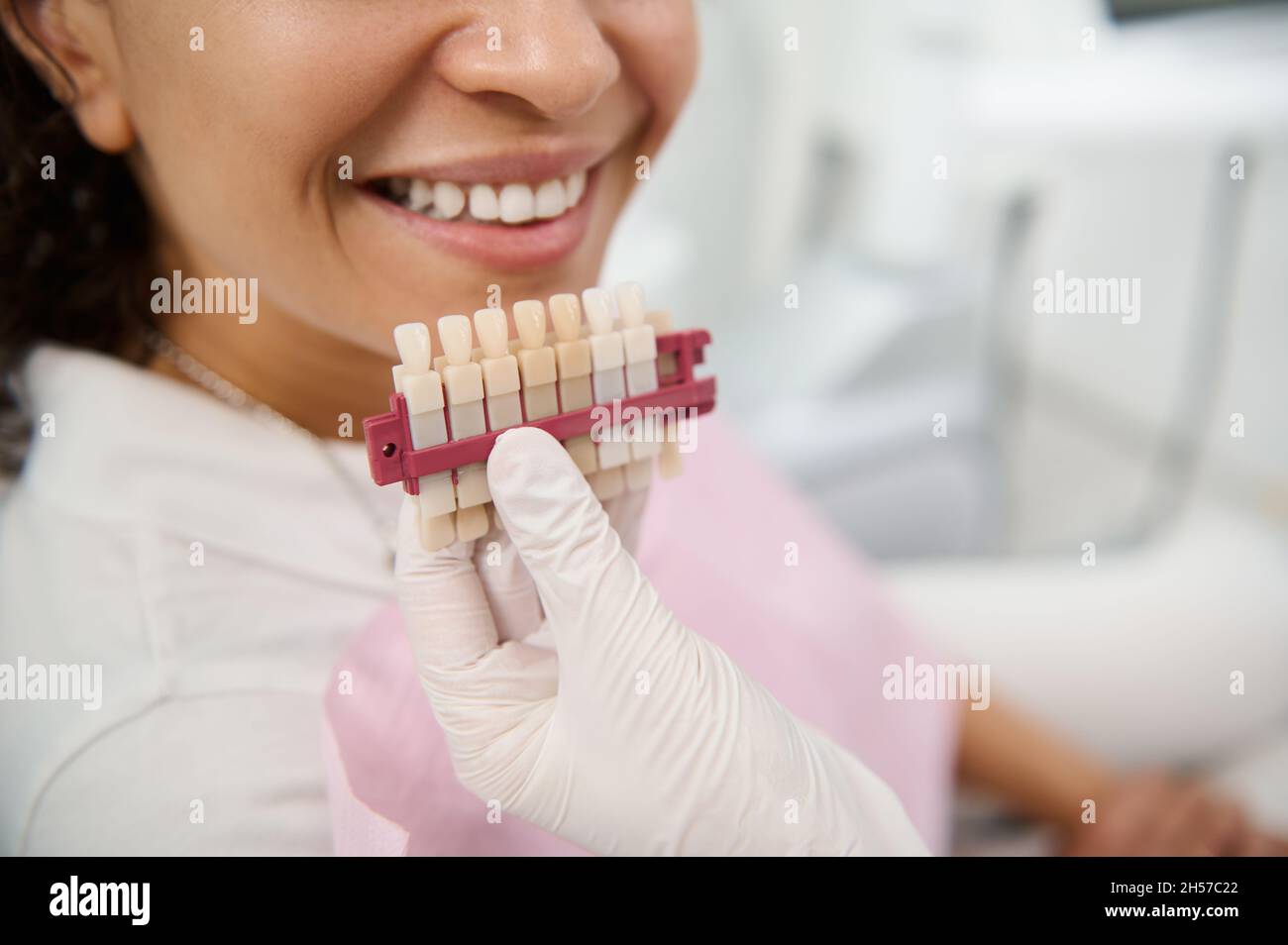 Tooth color chart hi-res stock photography and images - Alamy