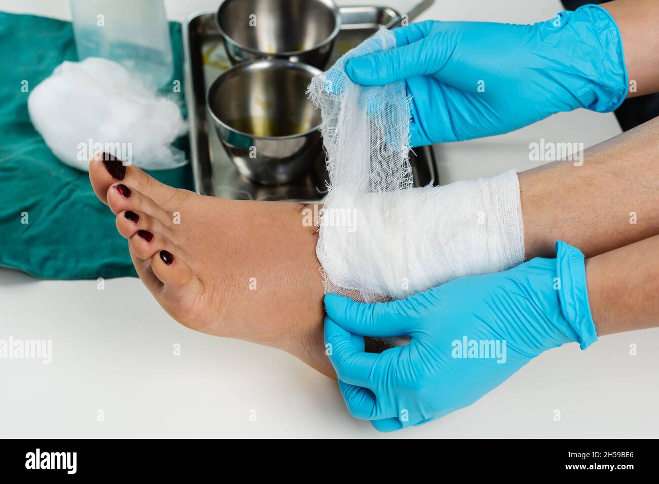 close up doctor bandaging patient's leg after cleaning wound Stock ...