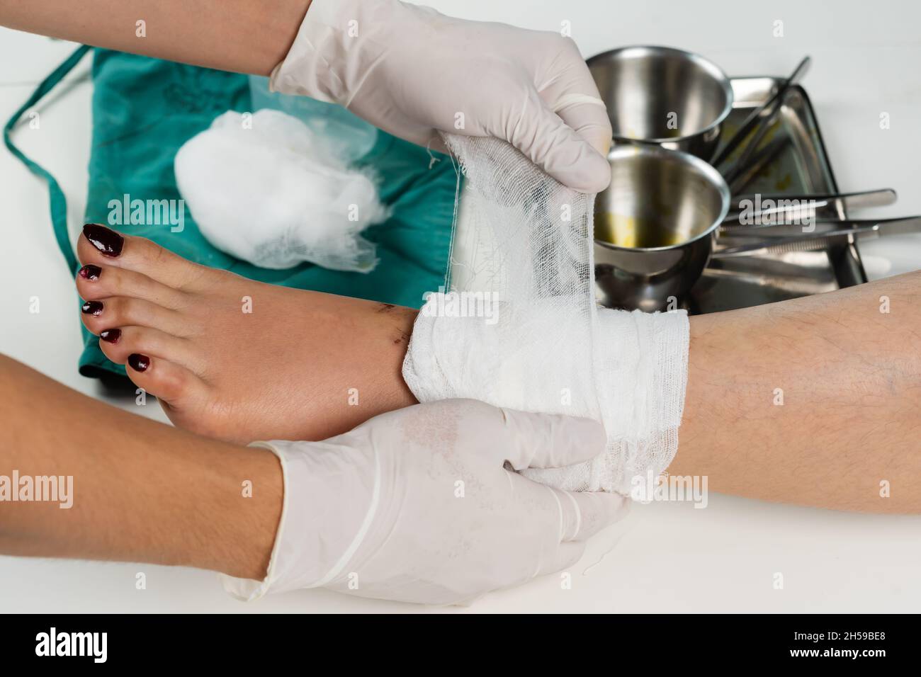 close up doctor bandaging patient's leg after cleaning wound Stock ...