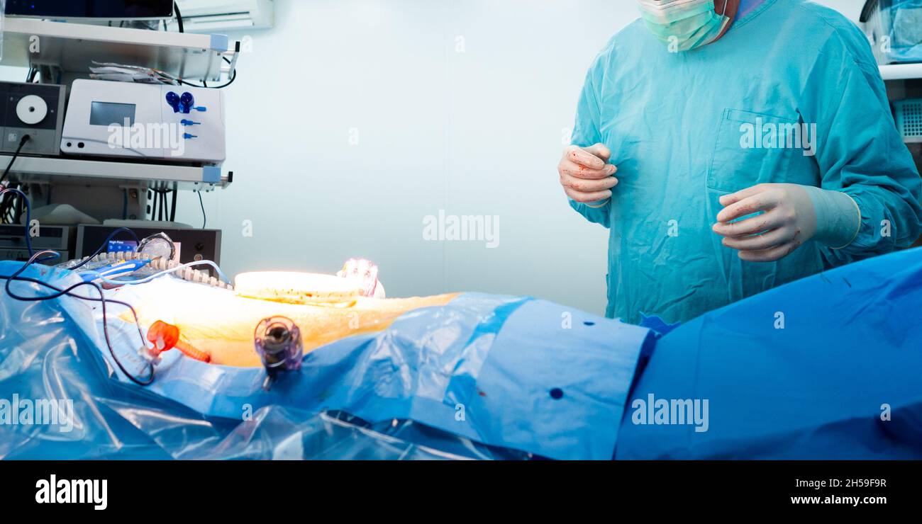 The surgeon standing in the operating room above the patient's body on ...