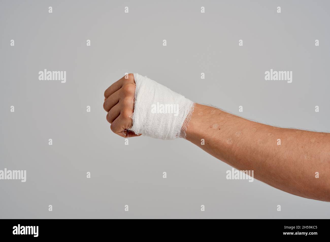 bandaged arm health problems pain injury Stock Photo - Alamy