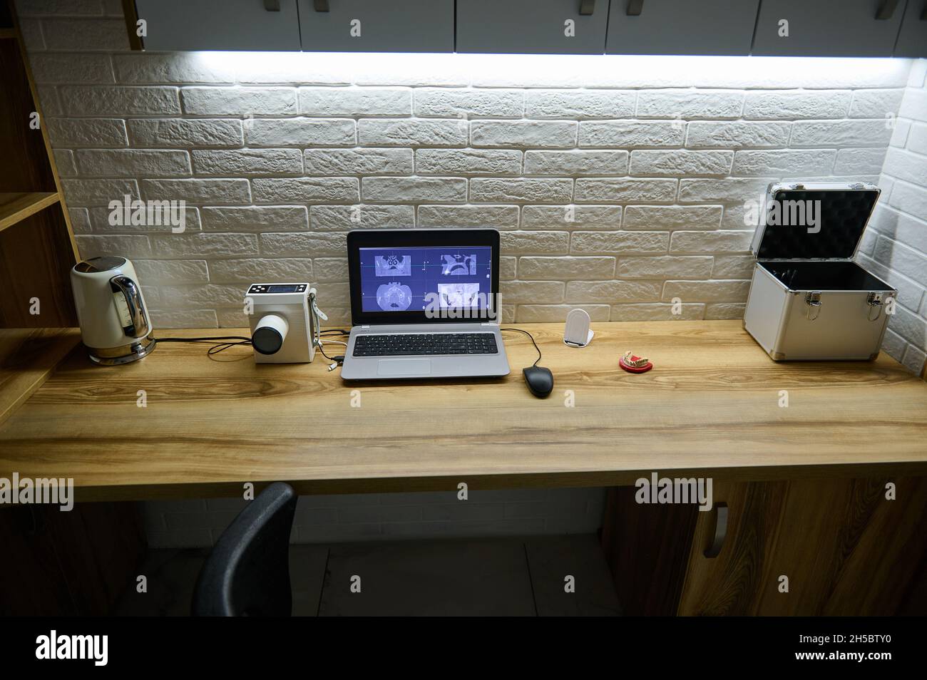 Laptop with dental X-ray on monitor screen, portable dental x-ray ...