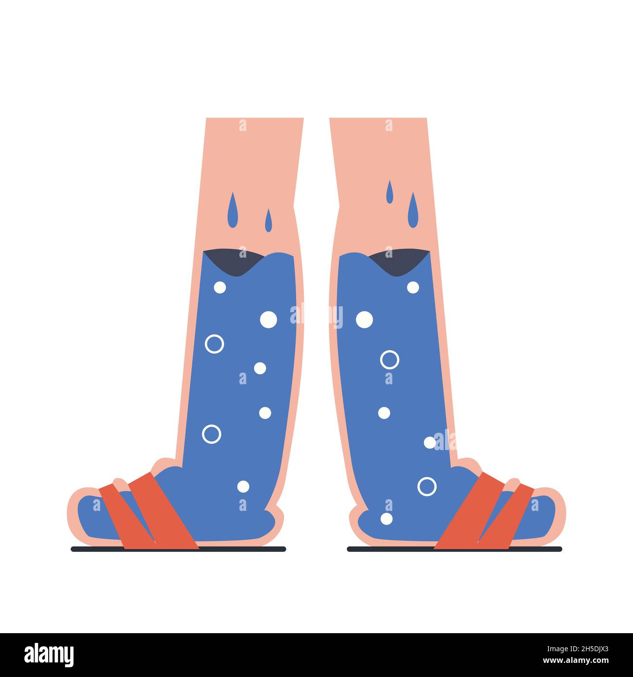 Swelling of the feet. Swollen ankles and feet. Vector illustration ...