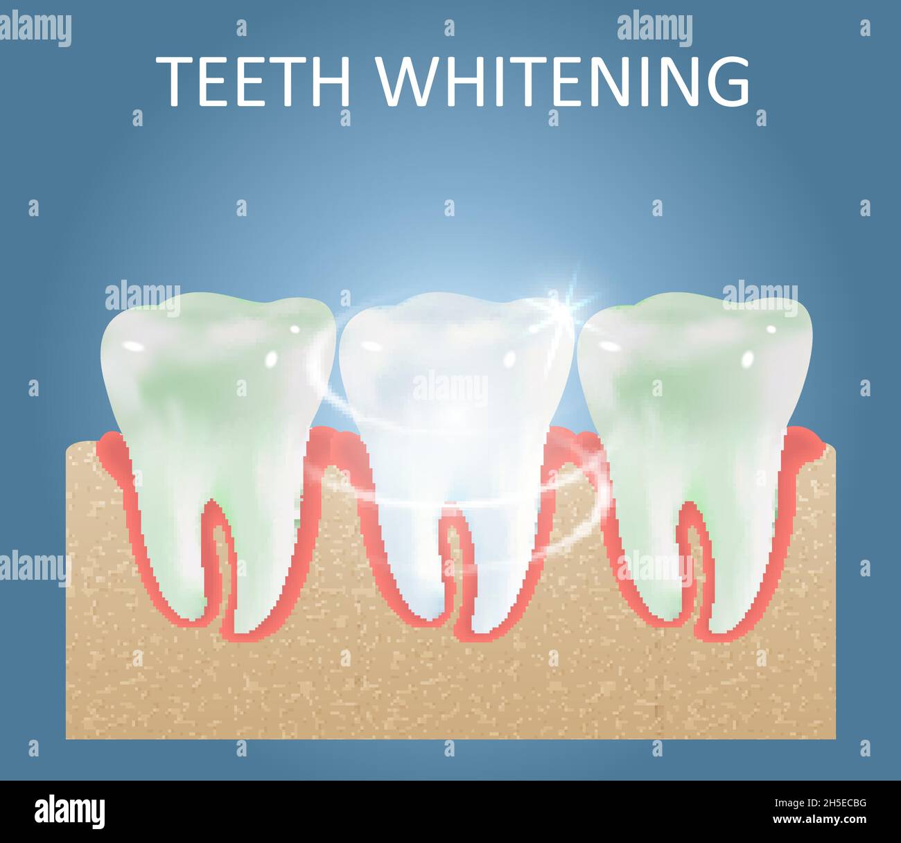 Teeth whitening vector medical poster design template Stock Vector ...