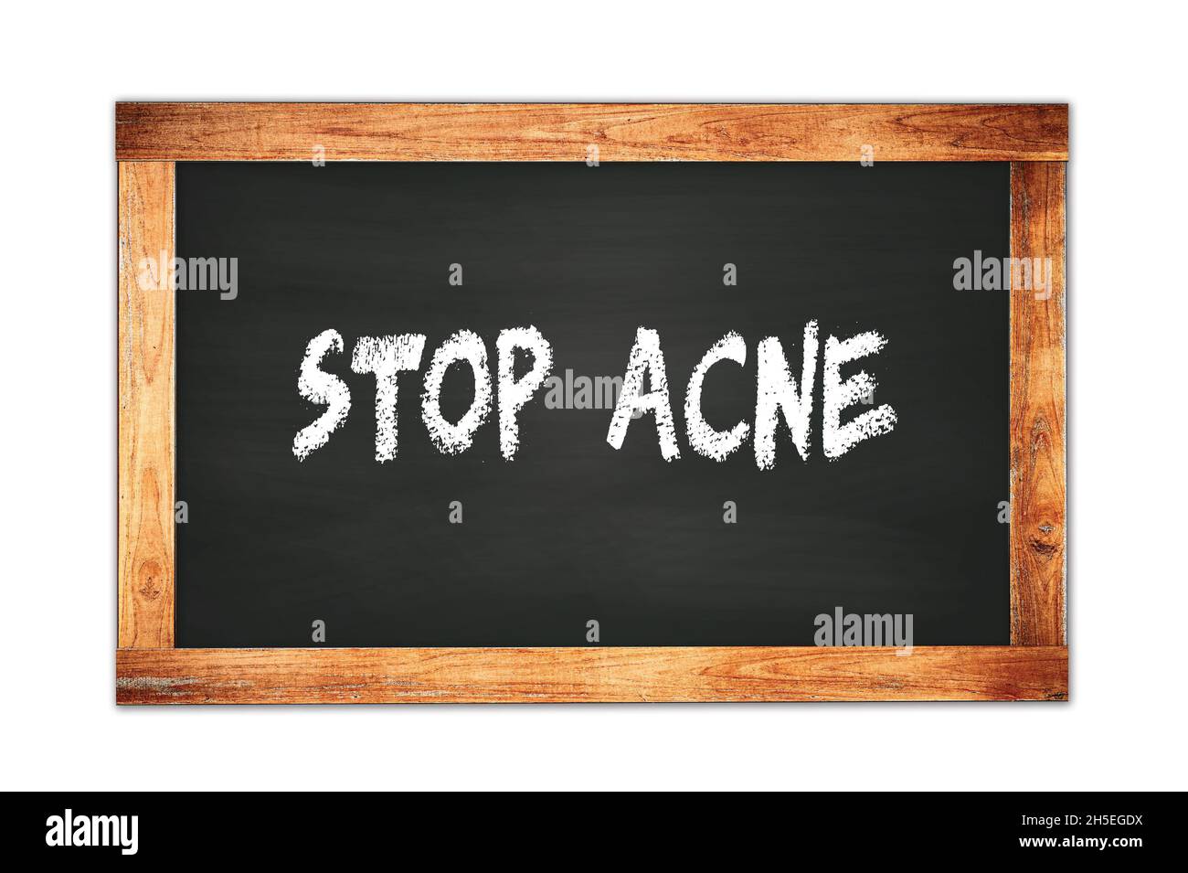 STOP ACNE text written on black wooden frame school blackboard Stock ...