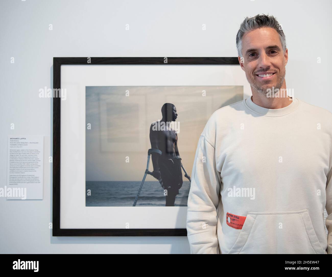 Brian Taylor Amputee