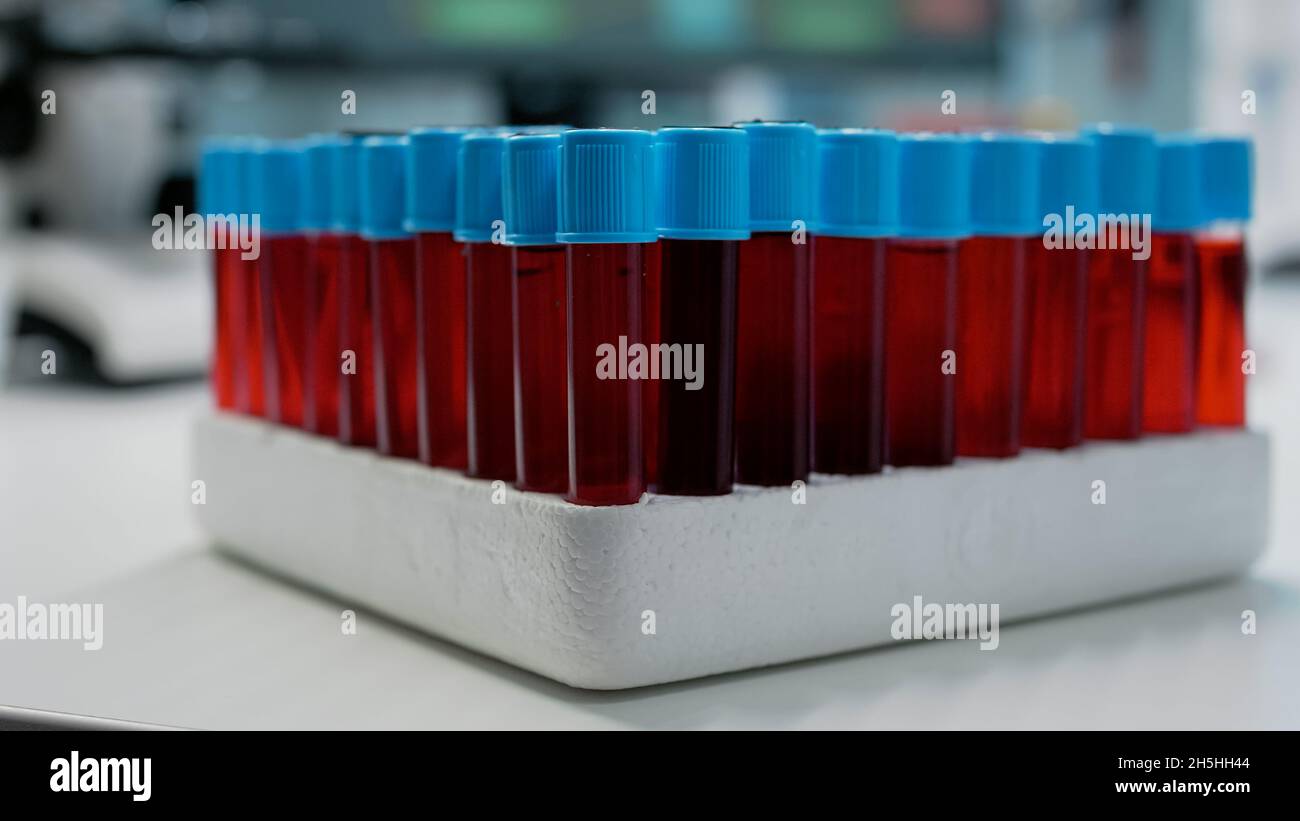 Close up of blood samples in vacutainers on medical tray in science ...