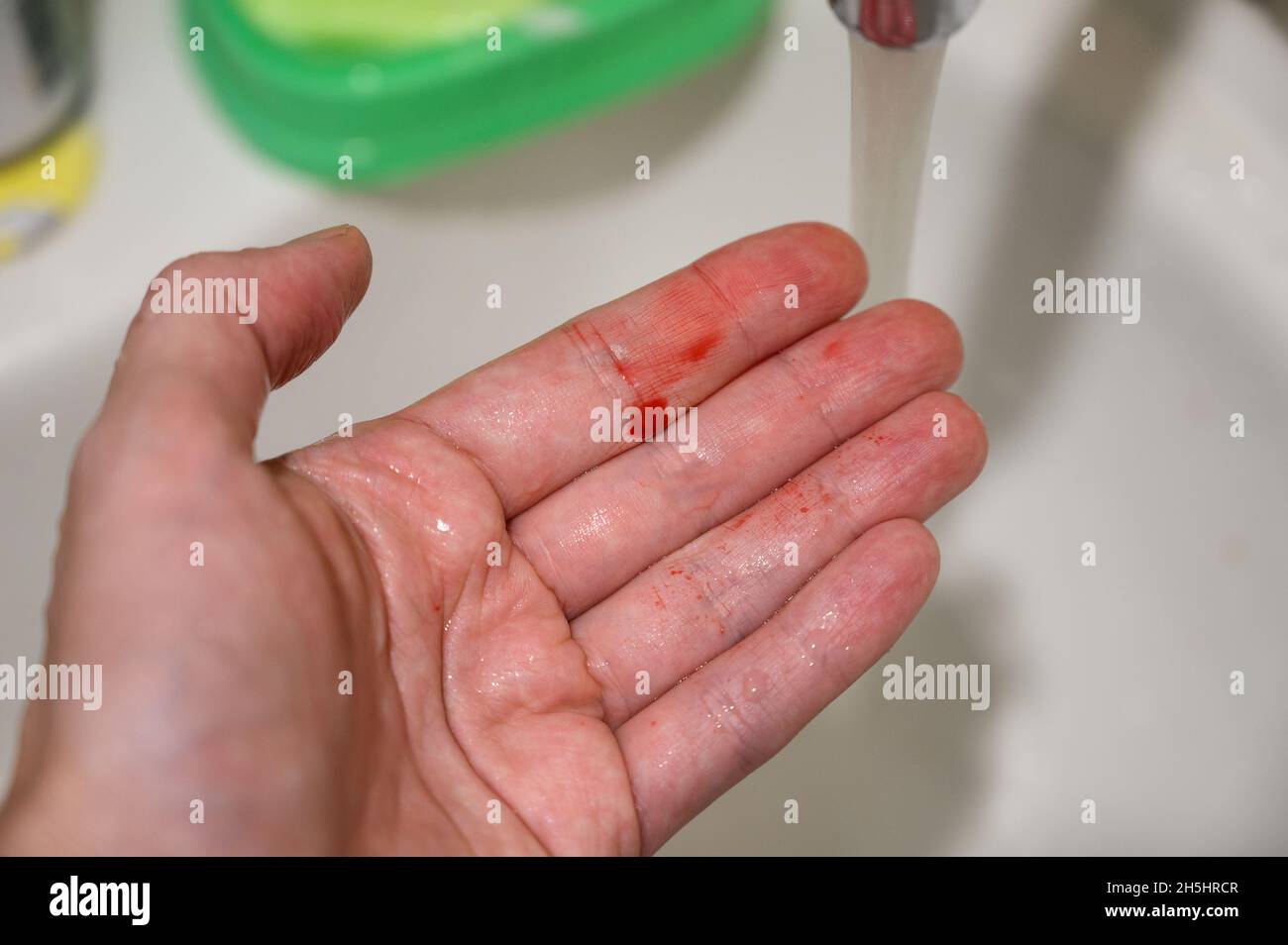 Human nose bleeding drop hi-res stock photography and images - Alamy