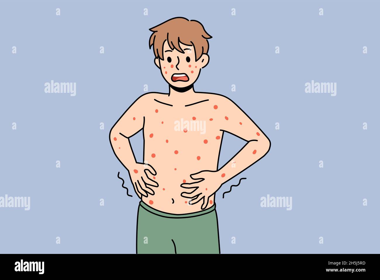 Unhealthy boy with red spots on body suffer from measles or rubella ...