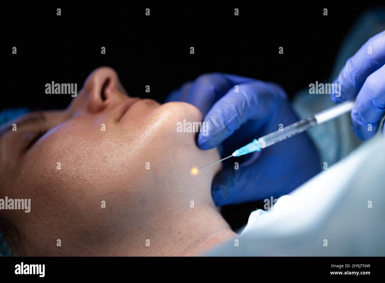 Doctor cosmetologist makes lipolytic injections to the patient's girl ...