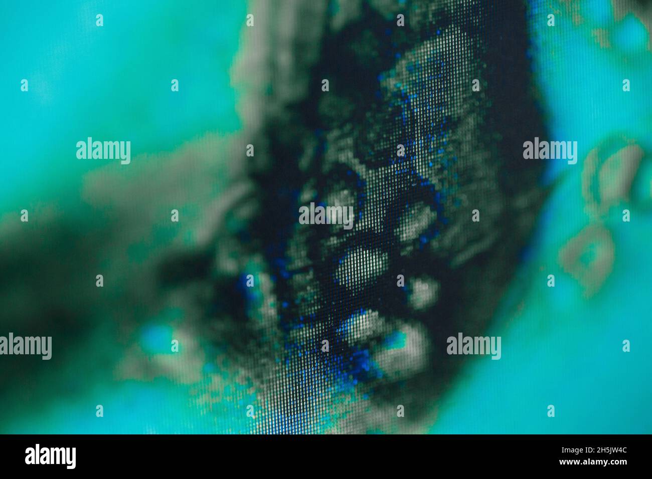 Mold under microscope hi-res stock photography and images - Alamy