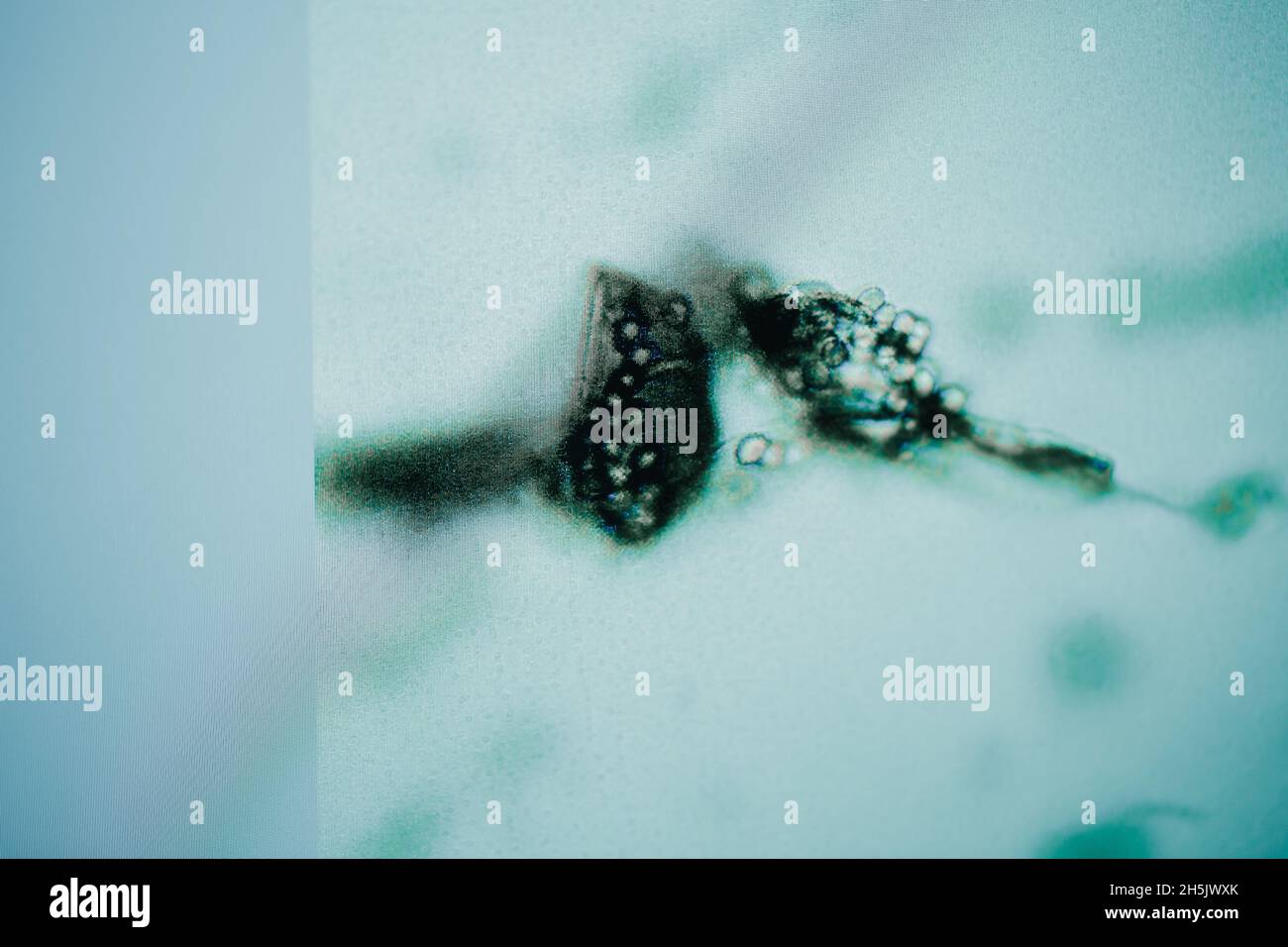 Cannabis mold under a microscope Stock Photo - Alamy