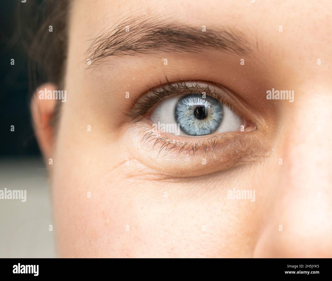 Young Eye Wrinkles