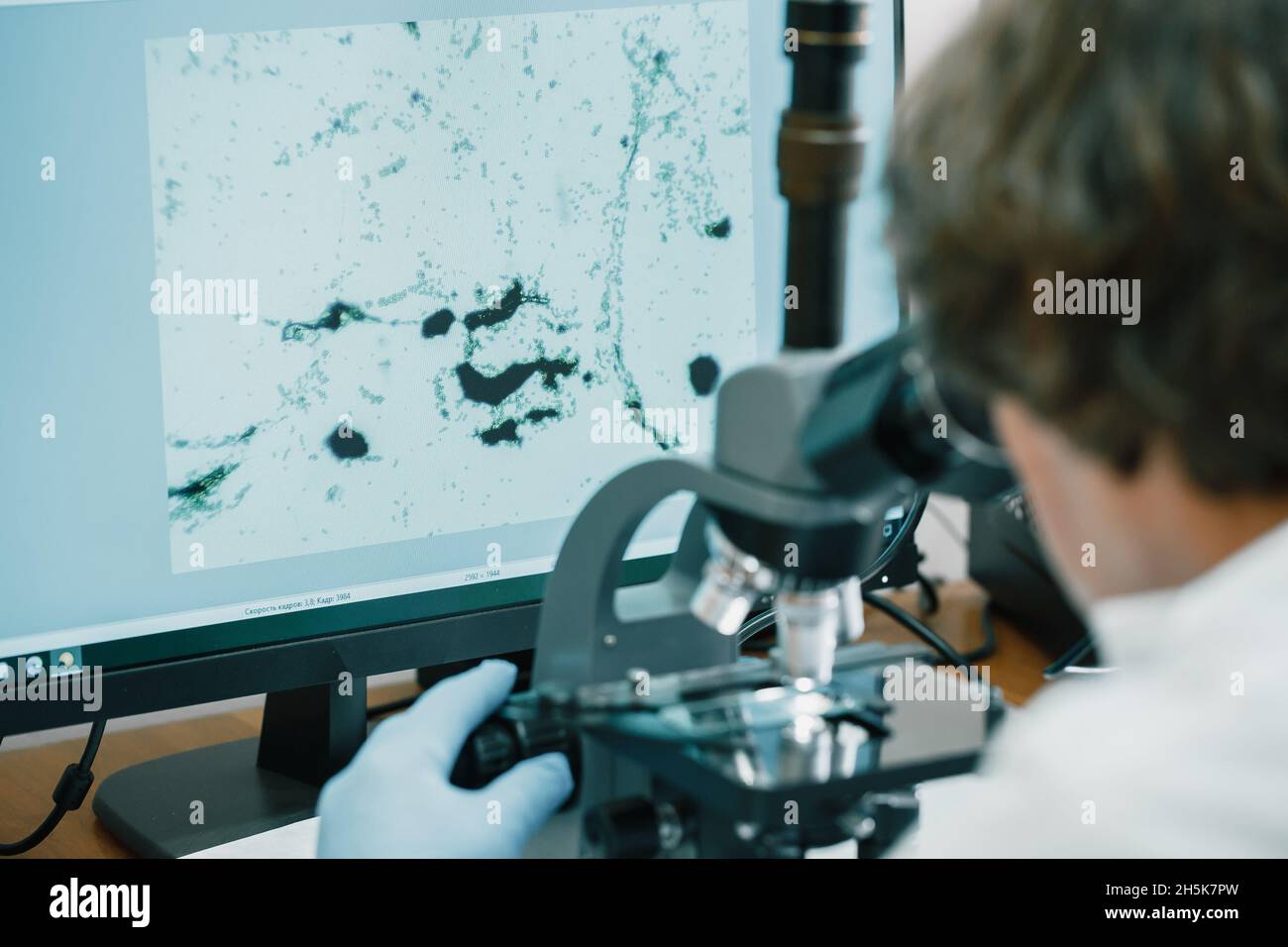 Scientist examines cannabis sativa mold through an electron microscope ...