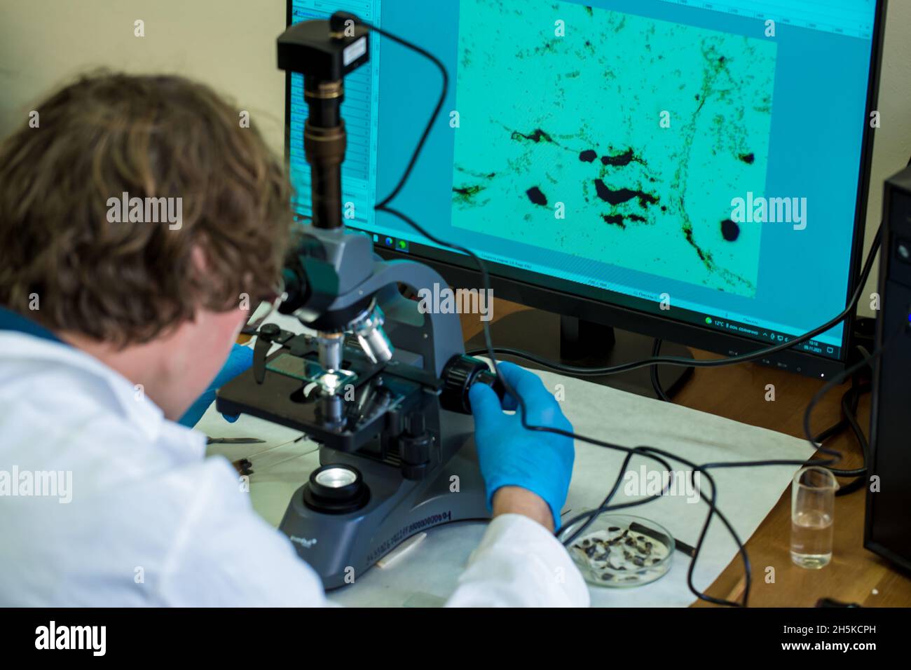 Scientist examines cannabis sativa mold through an electron microscope ...