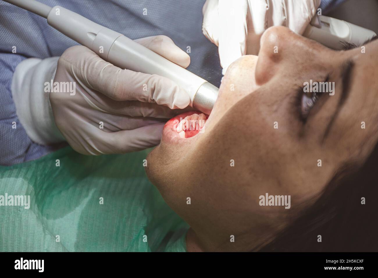Dentist works for dental cleaning in the mouth of a woman, with blood ...