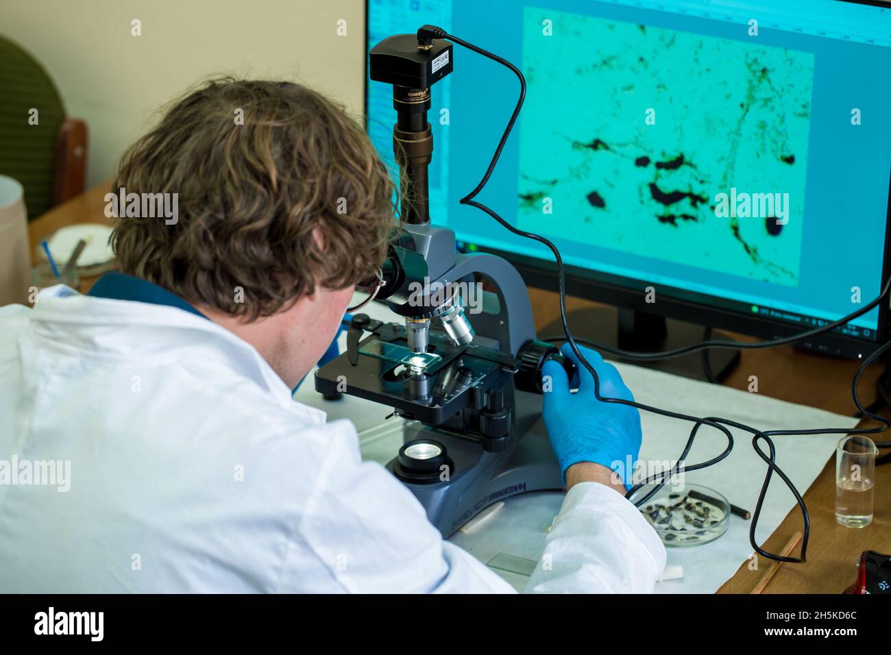 Scientist examines cannabis sativa mold through an electron microscope ...