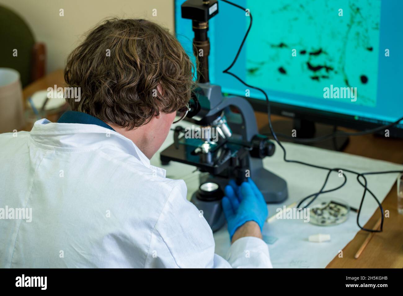 Scientist examines cannabis sativa mold through an electron microscope ...