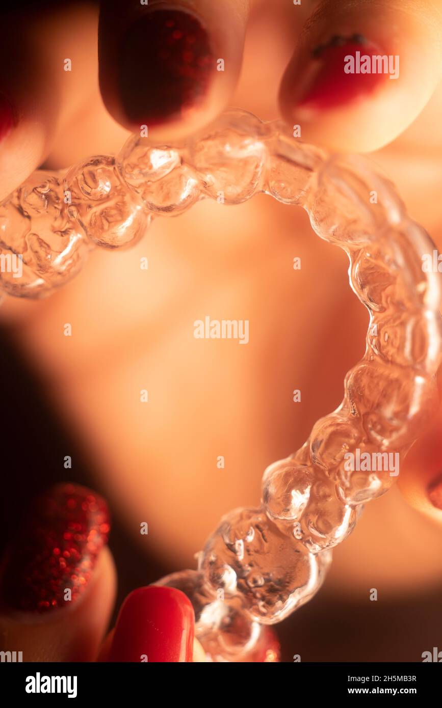 Invisible dental tooth bracket aligners to straighten teeth Stock Photo ...