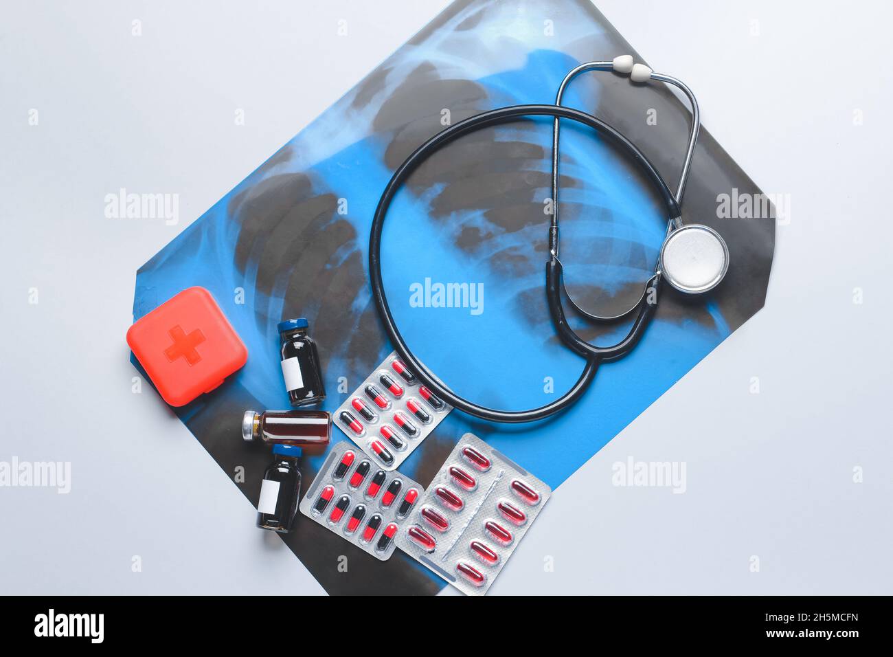 X-ray scan of lungs with stethoscope and medications on light ...