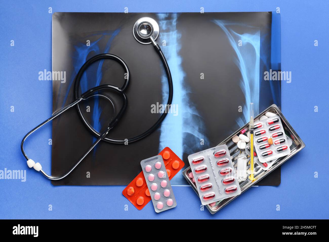 X-ray scan of lungs with stethoscope and medications on color ...