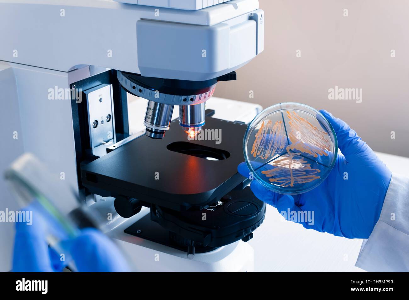 The scientist opened a petri dish with orange bacteria near the ...