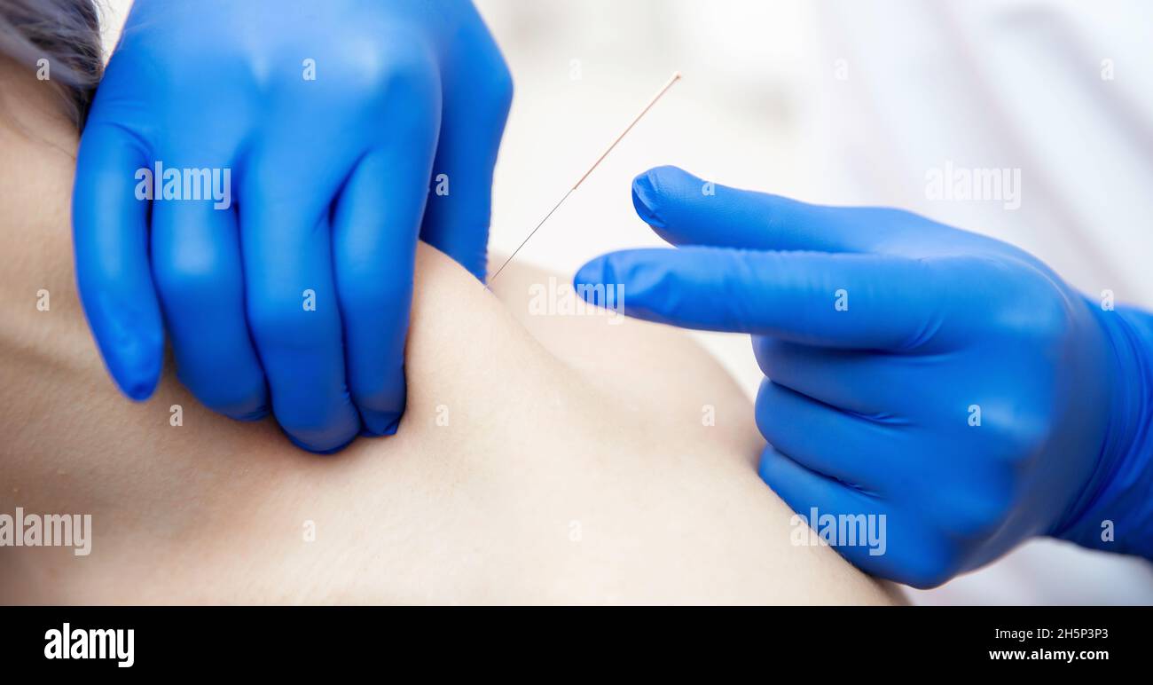 Banner Treatment of sports shoulder pain in young woman athlete with ...