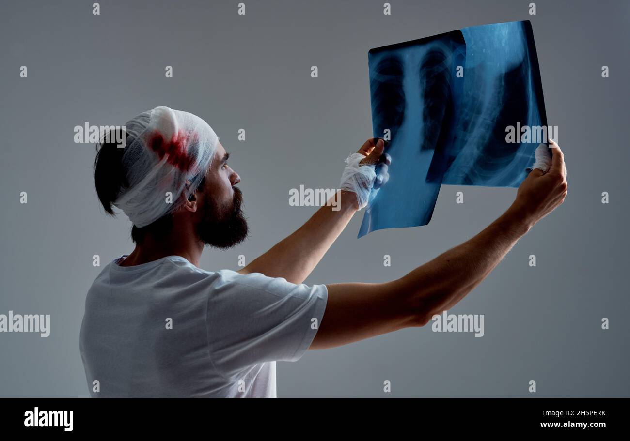 bearded man head injury radiology light background Stock Photo - Alamy