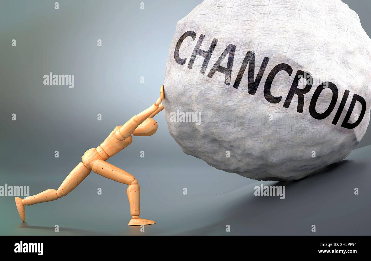 Chancroid depiction hi-res stock photography and images - Alamy
