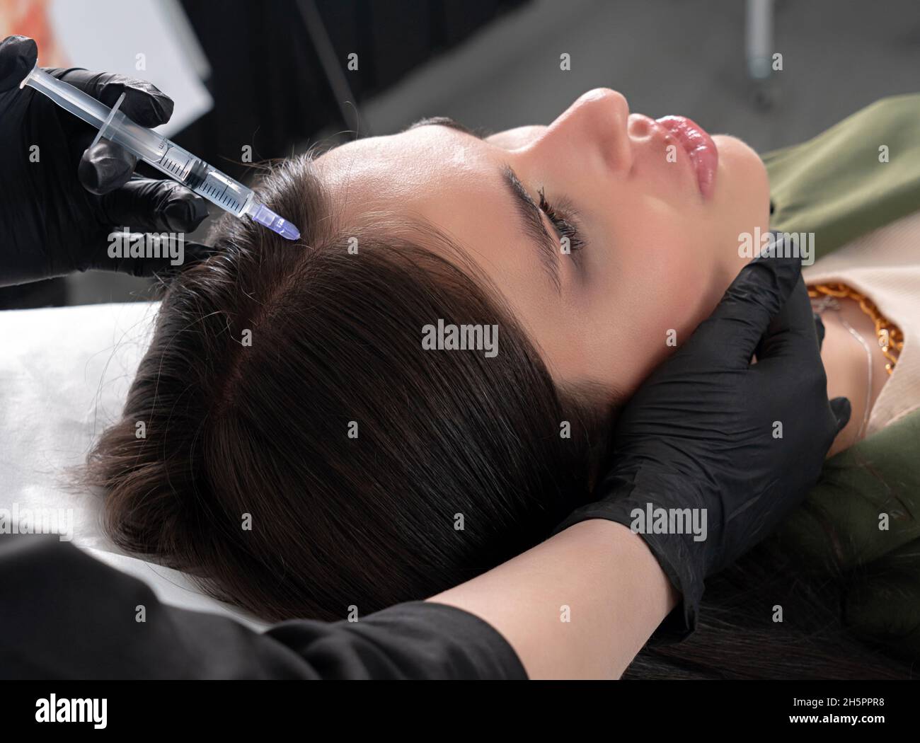 Young woman with hair problem receiving injection in head skin in a ...
