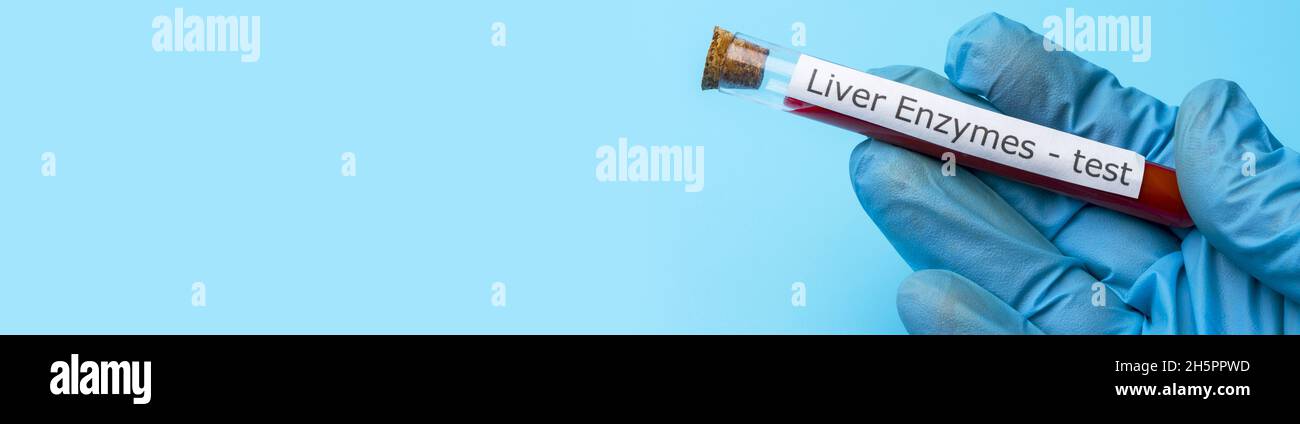 Hand Holding liver enzyme Test in vitro on Blue Background. The concept ...