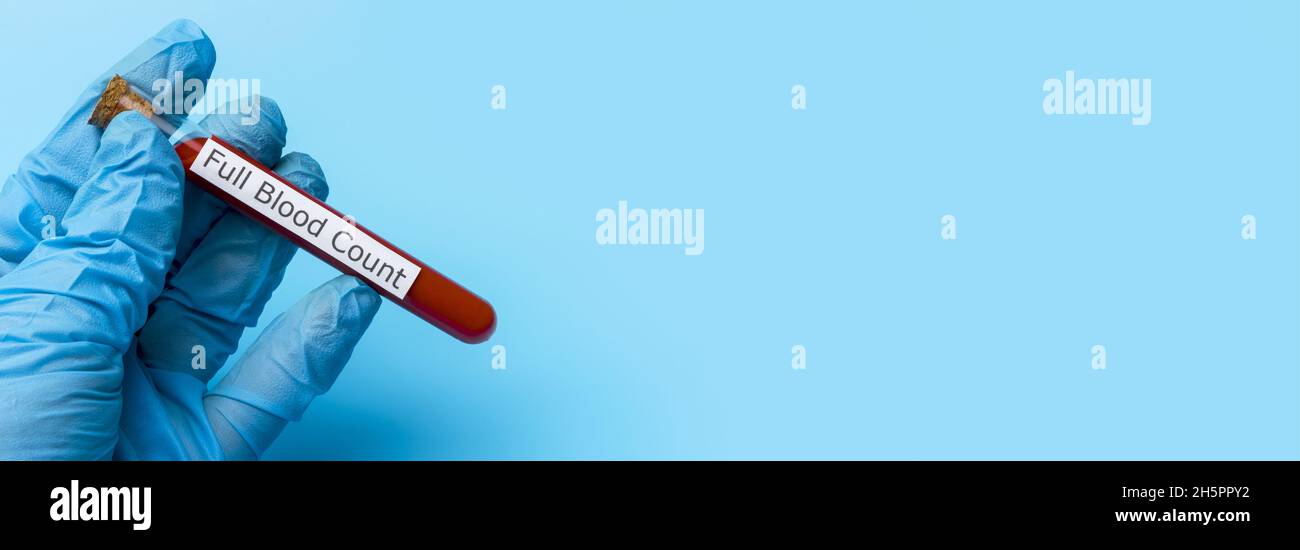 Hand Holding a Test for a Full blood Test in a test tube on a Blue ...