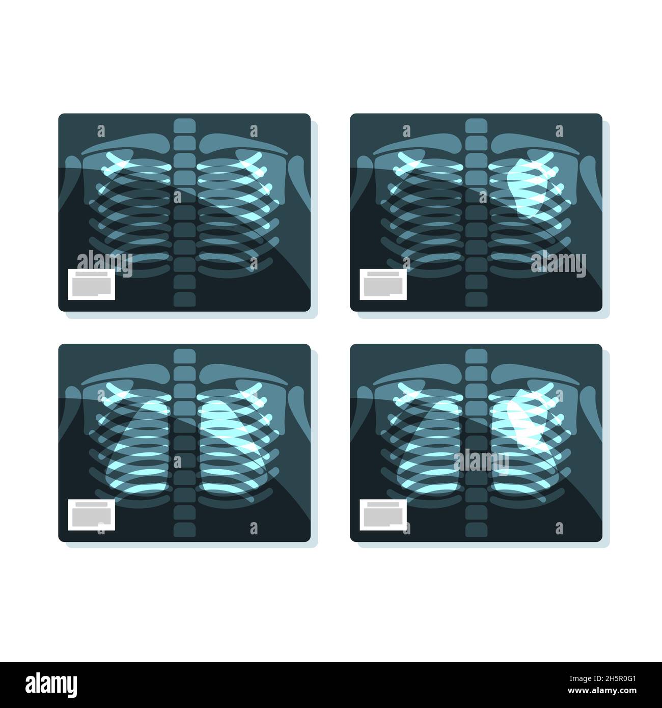 X-ray vector shot, roentgen flat radiology in medicine concept isolated ...