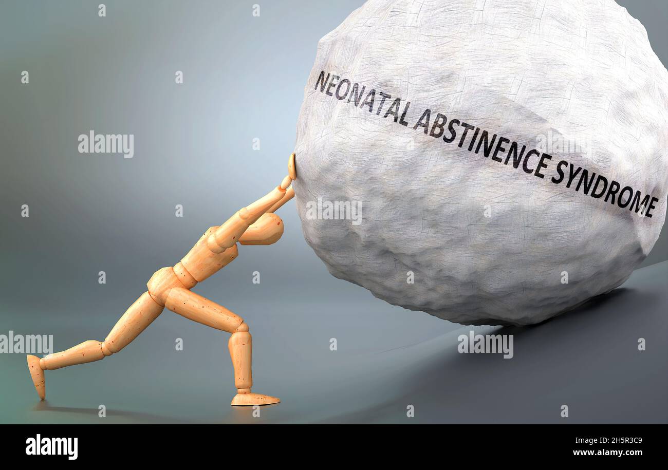 Depiction of Neonatal abstinence syndrome shown a wooden model pushing ...