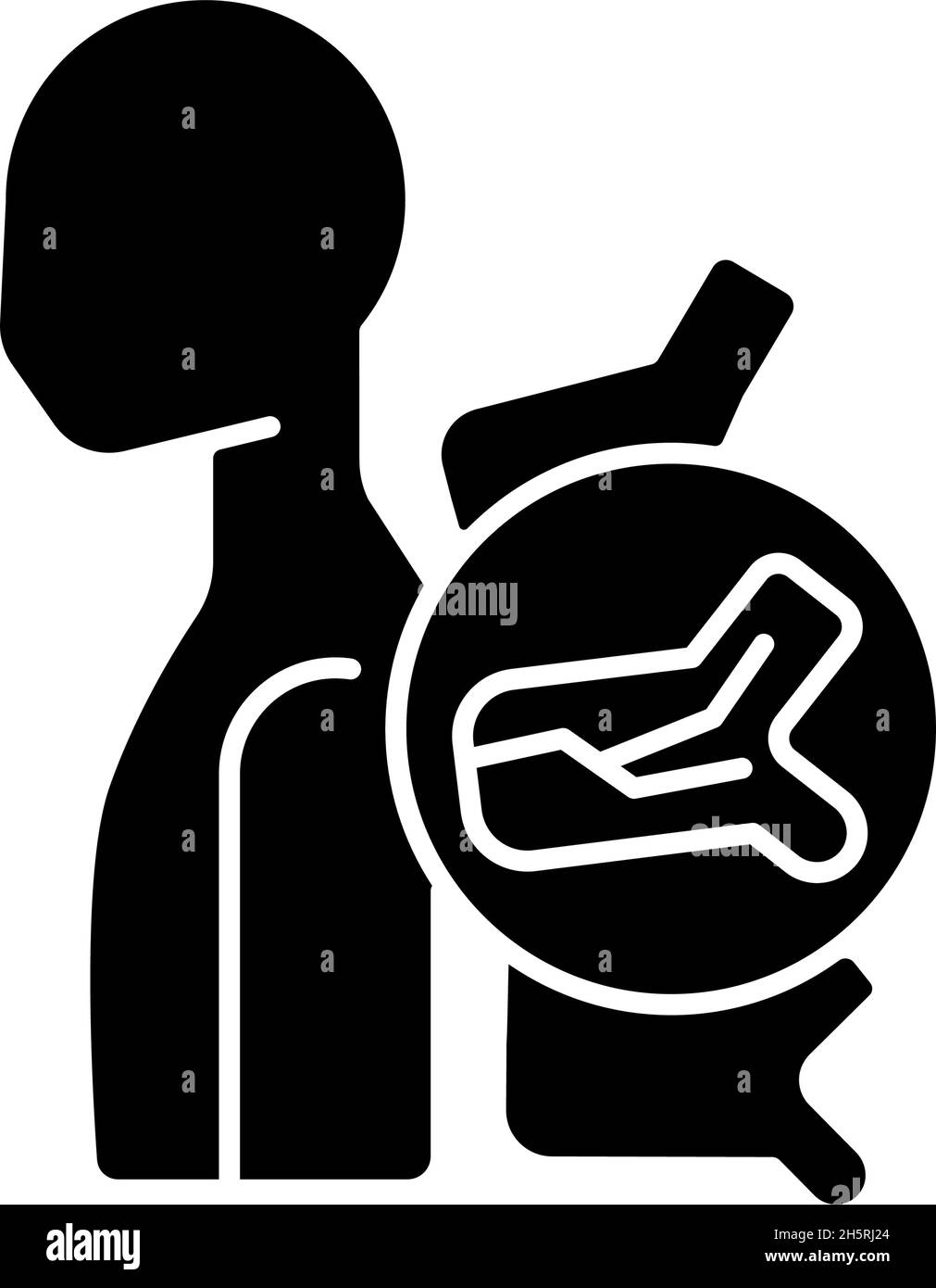 Simple fracture hi-res stock photography and images - Alamy