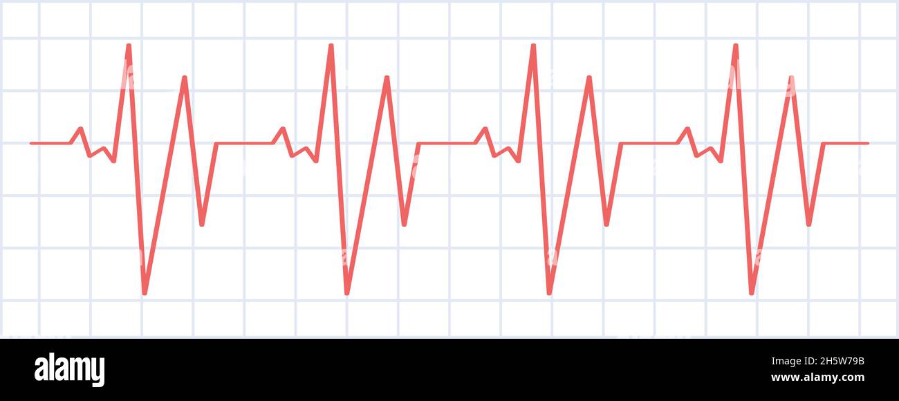 medicine chart, heart rhythms in flat style, vector Stock Vector Image ...