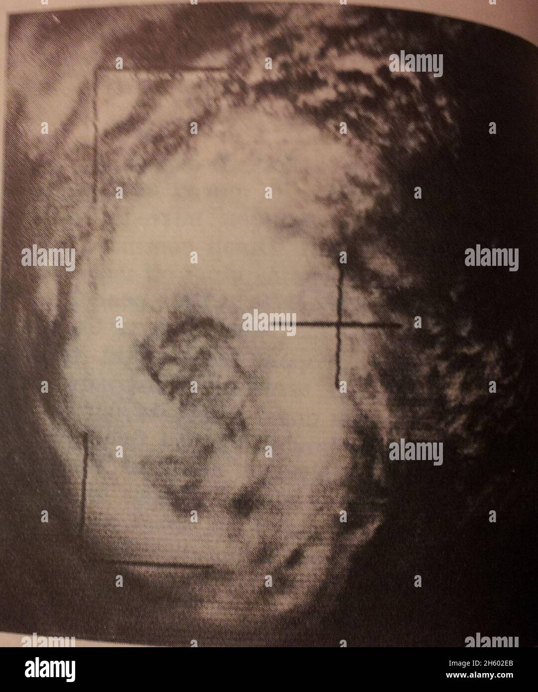 This picture of Typhoon Mary was taken by the TIROS VIII weather ...